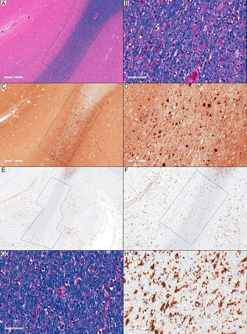 Loss of Ramified Microglia Precedes Axonal Spheroid Formation in Adult ...