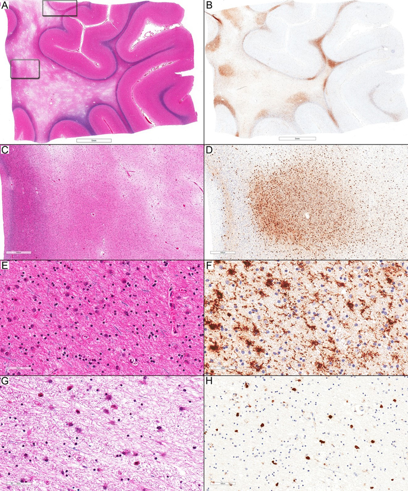 Loss of Ramified Microglia Precedes Axonal Spheroid Formation in Adult ...