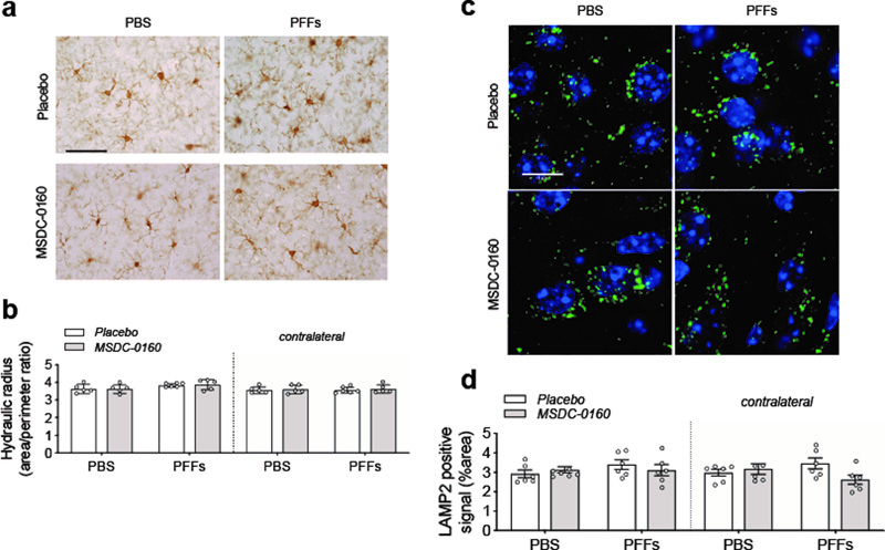 Inhibiting the mitochondrial pyruvate carrier does not ameliorate ...