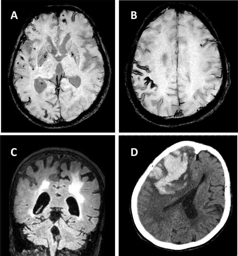 Neurovascular disease: 2022 update