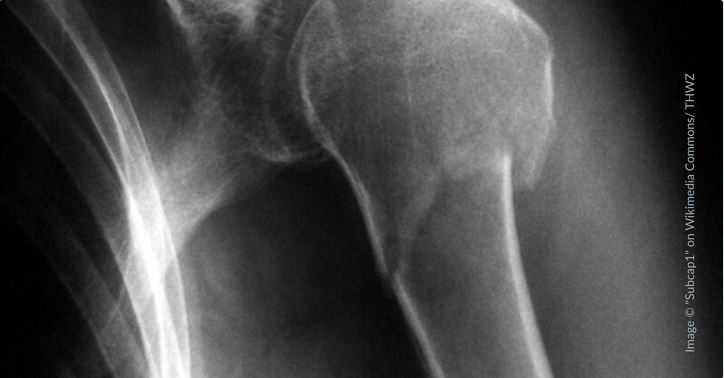 Amboss Blog: Operativ oder konservativ? Die Therapie der ...