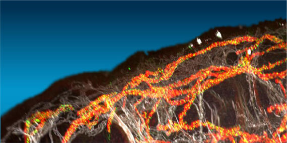 CRC 1450 “inSight – Multiscale imaging of organ-specific inflammation”