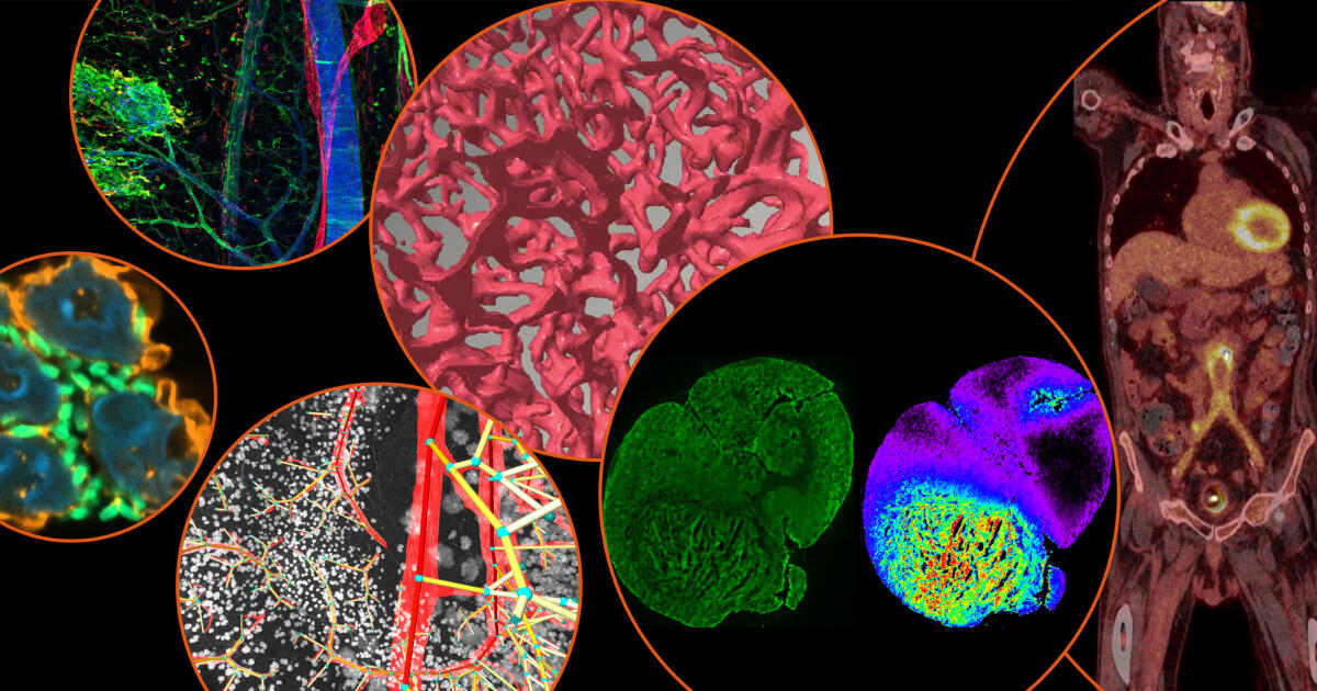 CRC 1450 “inSight – Multiscale imaging of organ-specific inflammation”