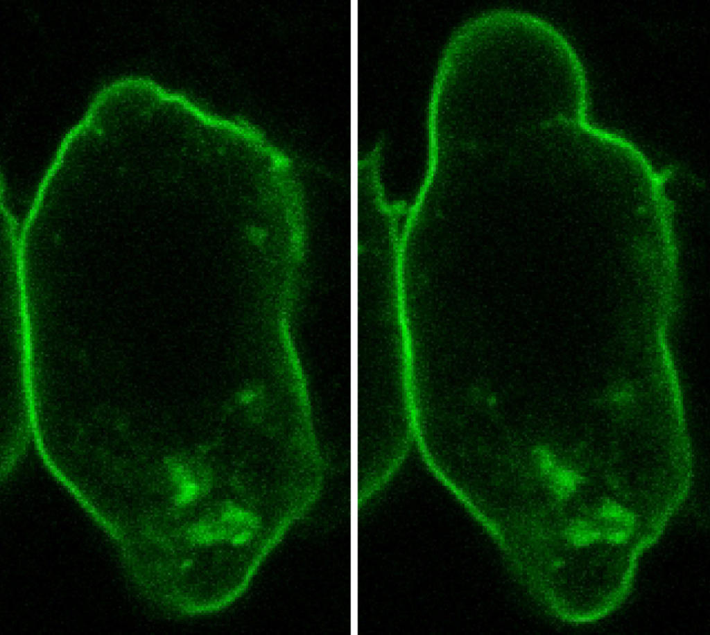 News | How do cells form blebs for their motility?