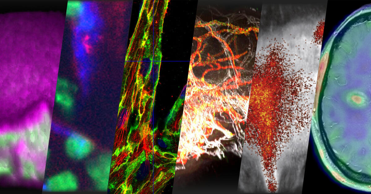 Forschung | Cells in Motion